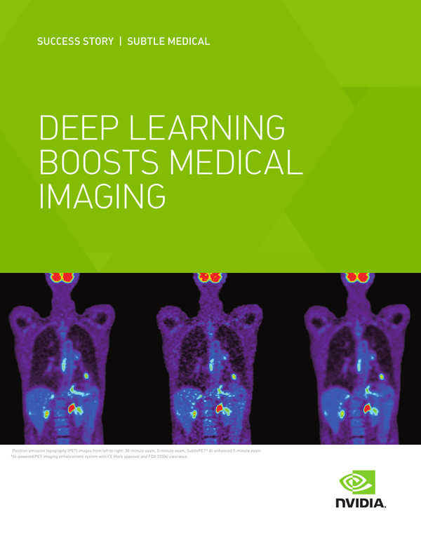 Deep Learning Boosts Medical Imaging